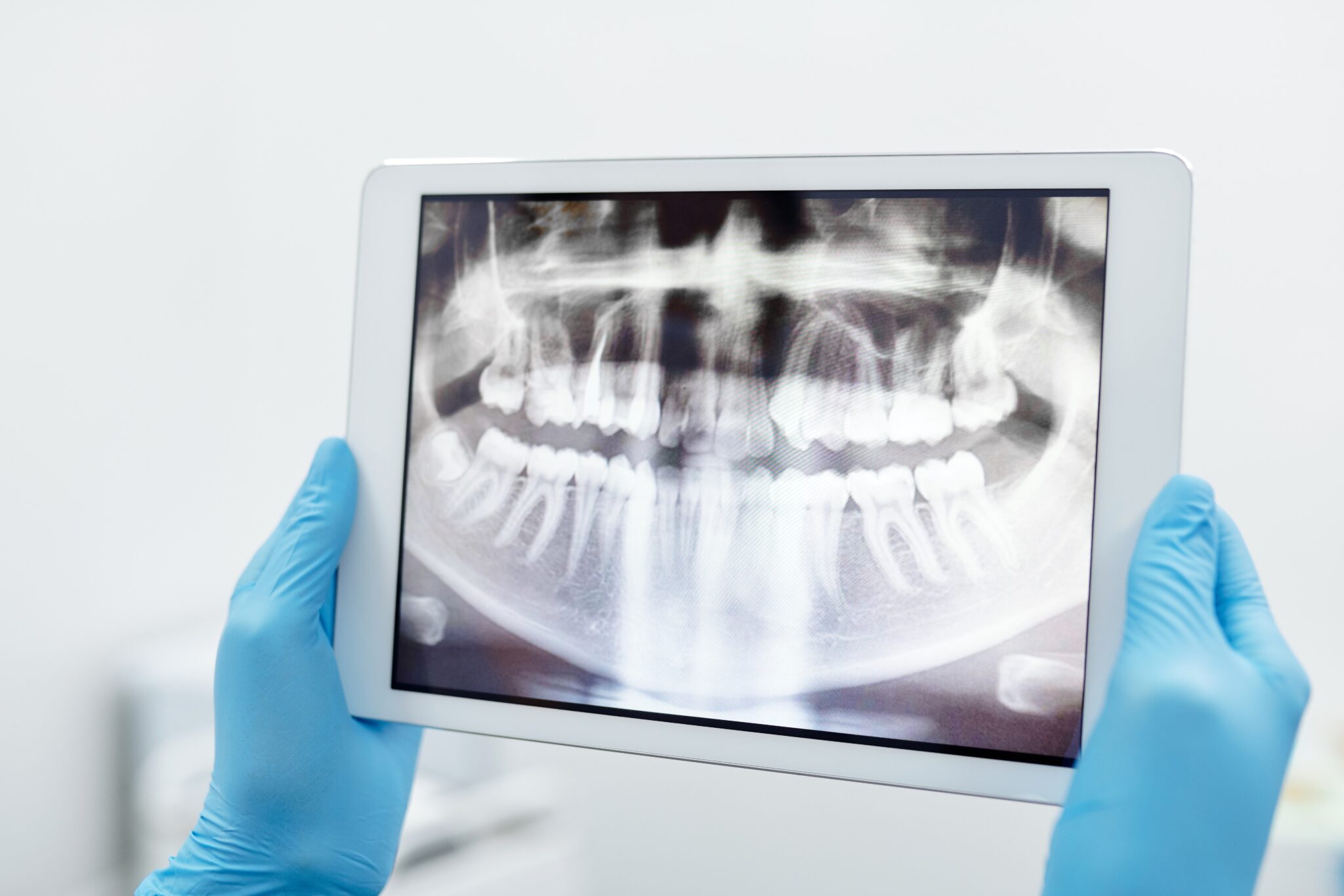 Dental 3D Scanner From Shining 3D